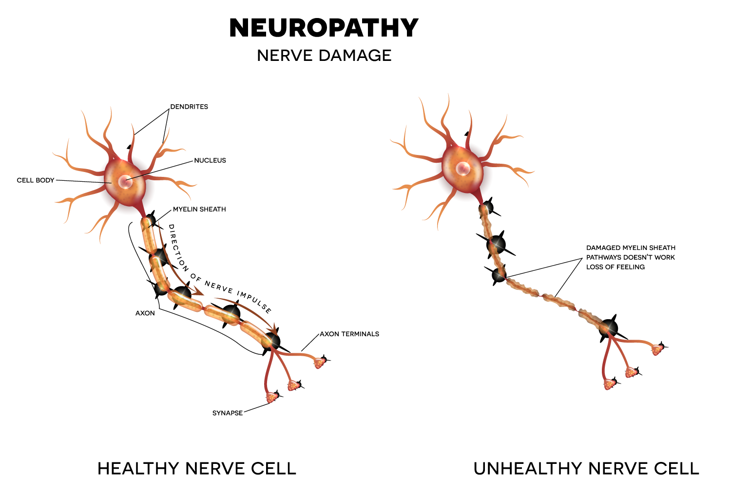 What is THCC? How is it Different From THC?